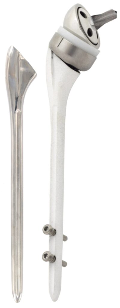 Humeral revision UNIC